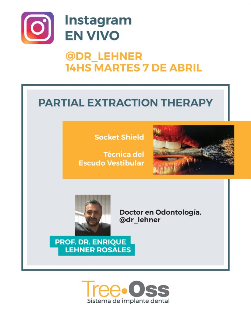 Live Instagram – Vestibular Shield Techniques – Dr. Lehner - Tree-Oss ...